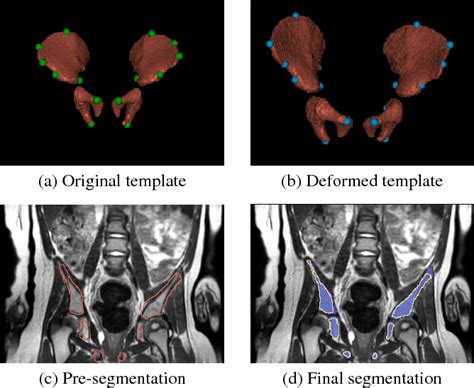 Figure 3 From A New Method Based On Template Registration And