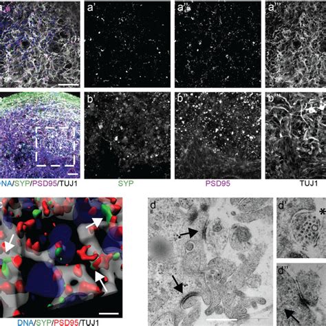 Single Cell Rna Sequencing Analysis Of Midbrain Specific Organoids A