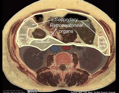 Retroperitoneal Diagram