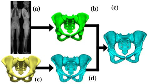 Full Article Subject Specific Hexahedral Finite Element Mesh