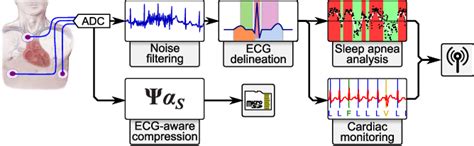 Figure 2 From Online Obstructive Sleep Apnea Detection On Medical