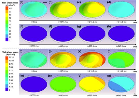 Fsi Predictions Of The Deformations And Wall Shear Stress Distributions