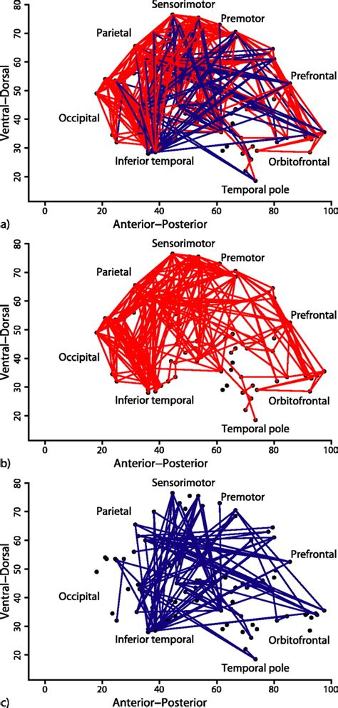 A Resilient Low Frequency Small World Human Brain Functional Network