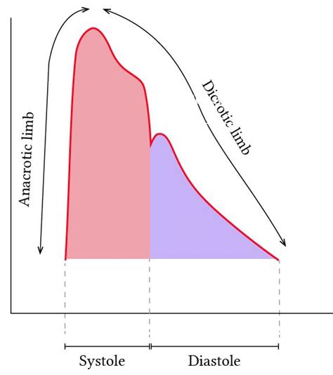 Normal Arterial Line Waveforms Deranged Physiology