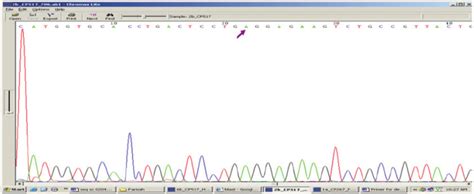 Dna Analysis Sequence Electropherogram Of A Normal Sample The Arrow