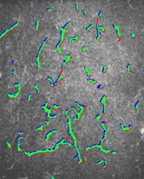 Detection And Segmentation Of Dendritic Cells With Deep Learning