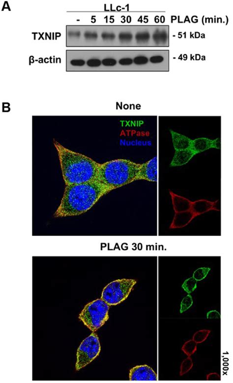 Plag Promoted Txnip Expression And Re Localization To The Membrane A