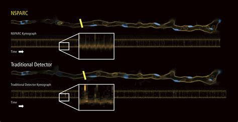 Ax Ax R With Nsparc Ax Ax R With Nsparc Confocal And