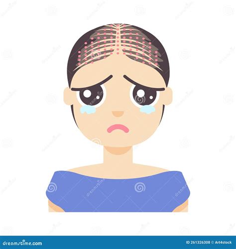 Treatment Of Alopecia Bald Spot Baldness Alopecia Mesotherapy