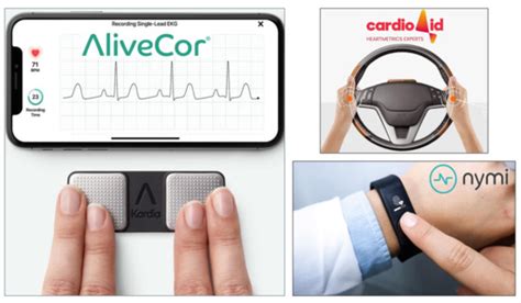 applied sciences free full text sex recognition through ecg signals
