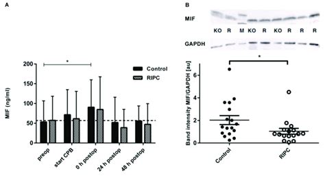 Macrophage Migration Inhibitory Factor Mif Concentration In Serum And