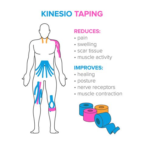 What Is Kinesiology Taping And Who Does It Help