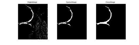 algorithm how to filter binary image with unwanted region and hole