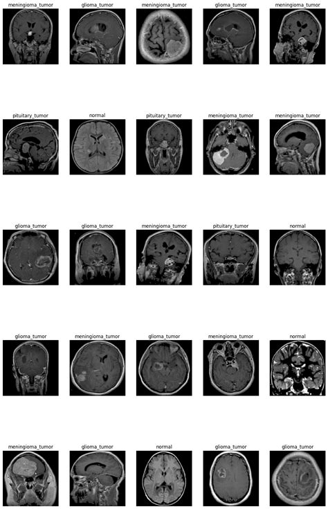 Github Mojtabazarreh Brain Tumors Classification Brain Image