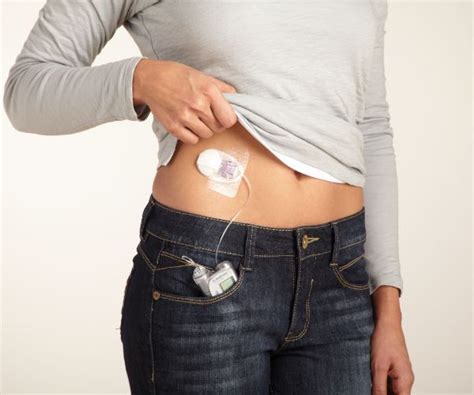 Medtronic Releases Minimed 640g With Advanced Glucose Control