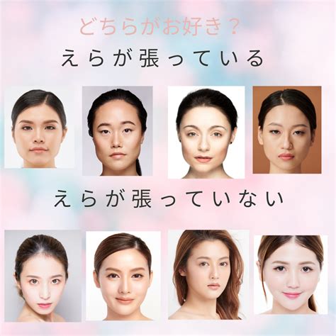 えらが張っているのと張っていないのとでどちらがお好きですか？ 南青山 皮膚科｜スキンソリューションクリニック青山通り