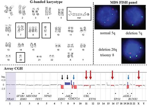 Integration Of Microarray Analysis Into The Clinical Diagnosis Of