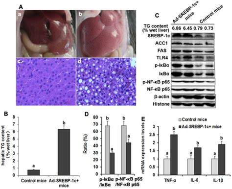 Srebp‐1c Increases The Hepatic Inflammatory Response In Dairy Cows With