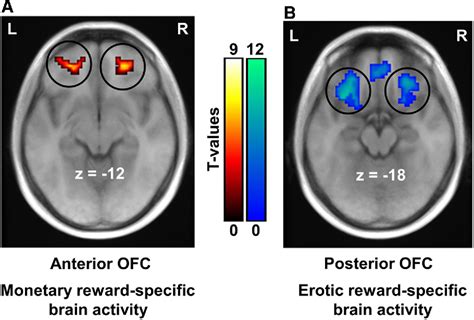 Figure 1 From Local Morphology Predicts Functional Organization Of