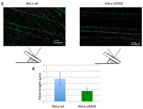 Smart Single Molecule Analysis Of Resection Tracks Technique For