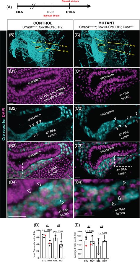 Smad4 A Critical Regulator Of Cardiac Neural Crest Cell Fate And
