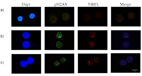 Dual Immunofluorescence Of ÃƒÅ½Ã‚Â³h2ax And 53bp1 In Human Peripheral