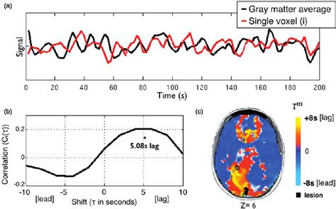 Using Temporal Cross Correlation To Measure Lag In Resting State Fmri