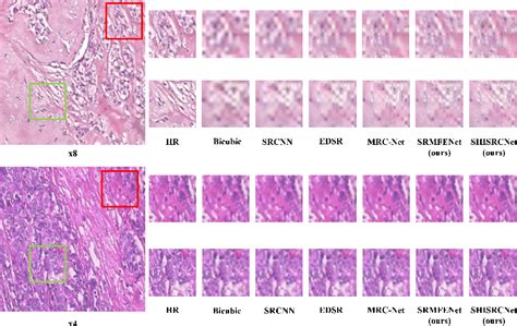 Figure 2 From Shisrcnet Super Resolution And Classification Network