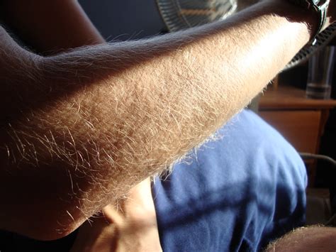 Blonde Hairy Arms A Photo On Flickriver