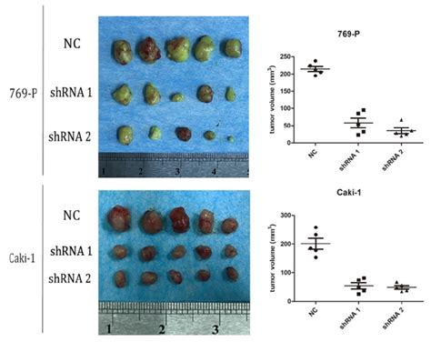 A2br Blockade Inhibited Cell Growth Of 769 P And Caki 1 Cell Lines In