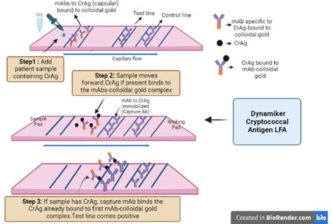 Workflow Of Dynamiker Cryptococcal Antigen Lateral Flow Assay Lfa For