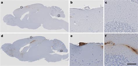 Aβ Plaque Deposition And Caa In Appnl F Nl F Mice Following Inoculation