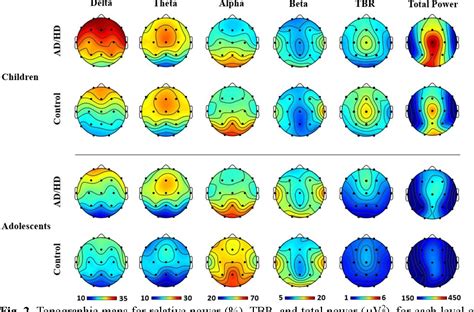 Figure 2 From Examining Resting State Eeg Features And Comparing Non