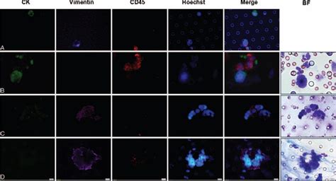 Immunofluorescent Staining For Characterization Of Ctcs Ctm Detected By