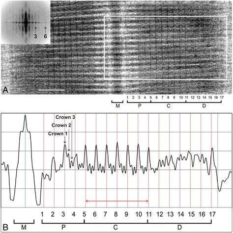 Direct Visualization Of Myosin Binding Protein C Bridging Myosin And