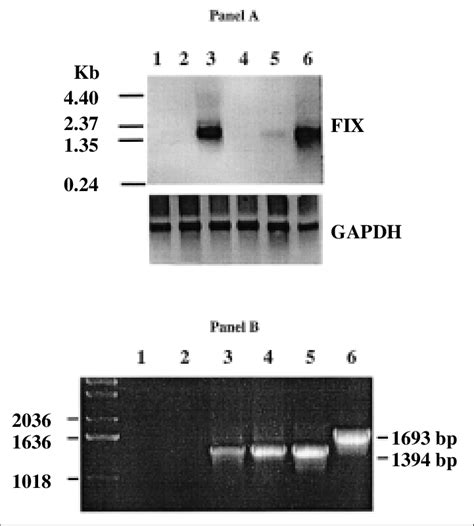 Northern Blot Analysis Following Electrophoresis In A 1 2 Agarose Gel