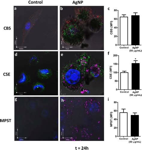 Cellular Uptake And Distribution Of Agnps Combined With Cbs Cse And