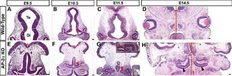 Defects In Ap 2a Ko Cranial And Ocular Regions Arise During Early Eye