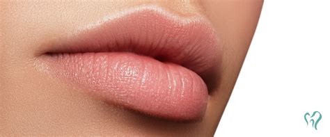Preenchimento Labial Entenda Tudo Sobre Esta Técnica