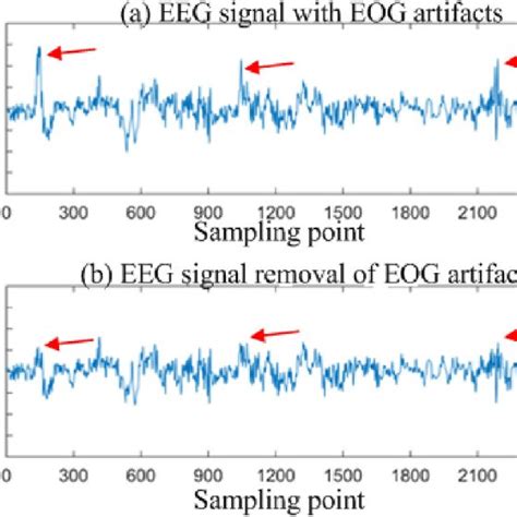 Comparison Of Original Eeg Signal And Removal Of Eog Artifacts