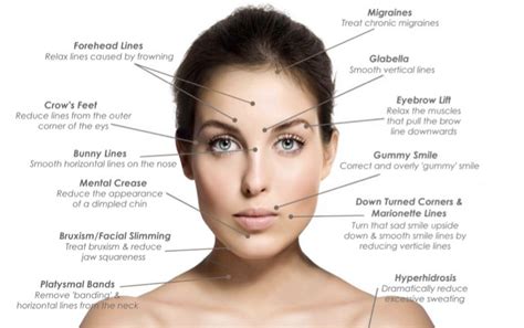 Botox® Xeomin® Dysport®