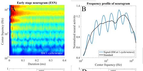 The Effects Of Duration And Level On Spectral Modulation Perception