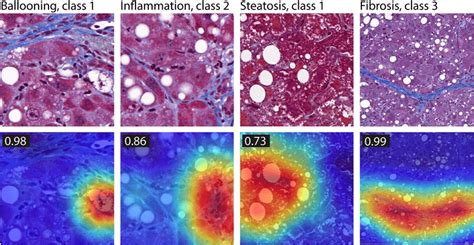 Examples Of Class Activation Maps For The Four Convolutional Neural