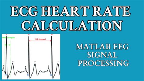 Ecg Signal Processing Using Matlab Ecg Heart Rate Calculation R