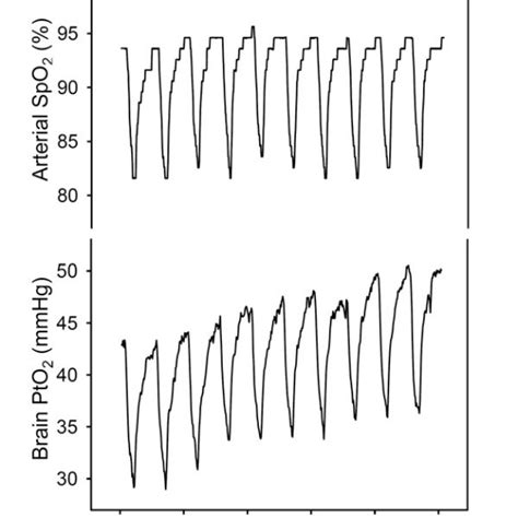 Example Of Oxygen Arterial Saturation Spo2 And Brain Tissue O2