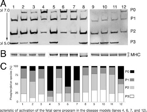 Figure 1 From Cardiac Myosin Binding Protein C Phosphorylation And