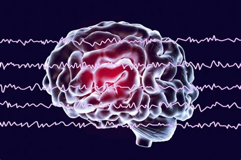 Ondas Alfa ¿por Qué Es Importante Estimularlas Mejor Con Salud