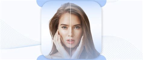 Transforming Beauty Captivating Dermal Fillers Before And After Ogomed