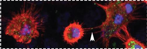 Tnts Connecting Inflammatory Macrophages Adhering To The Corneal