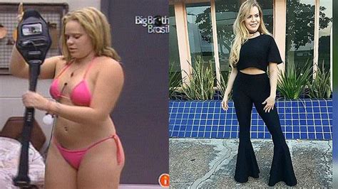 Ex Bbb Mostra Antes E Depois De Perder Mais De 40kg E Deixa Fãs